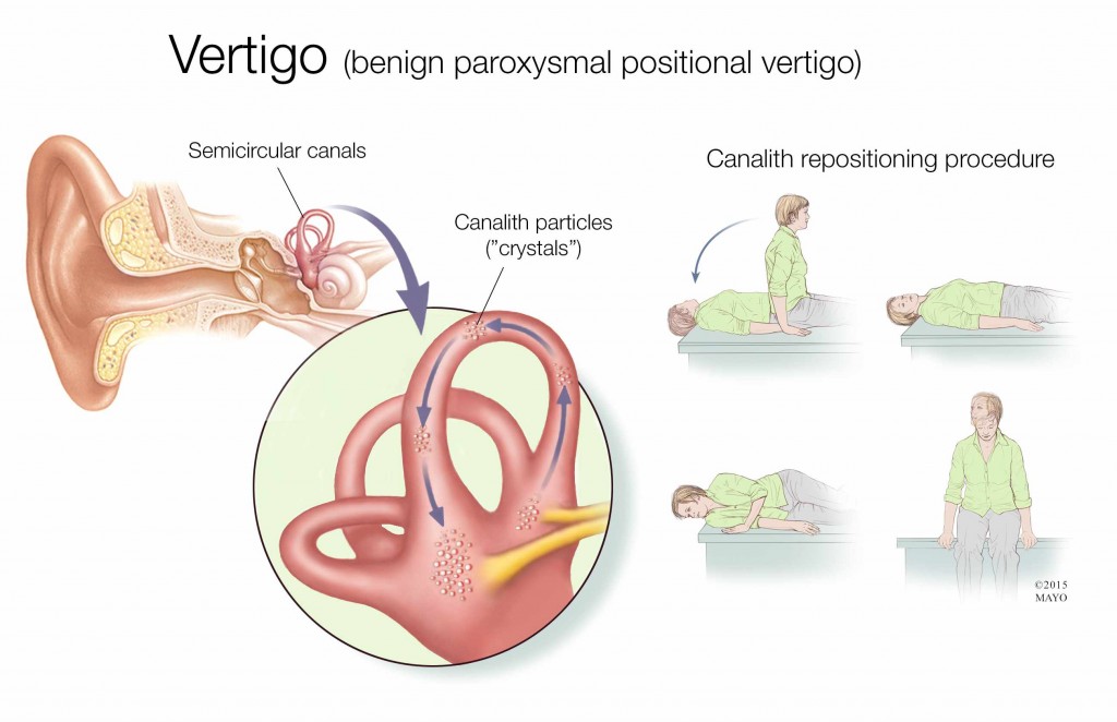 Vertigo? | V.L. Makabali Memorial Hospital, Inc.