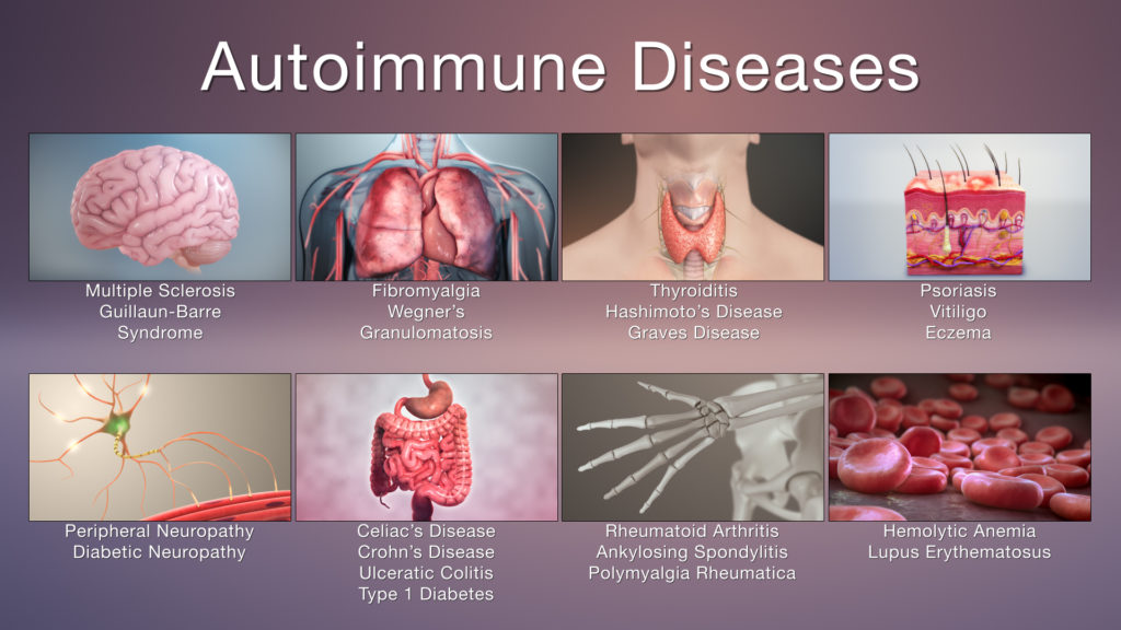 Autoimmune diseases | V.L. Makabali Memorial Hospital, Inc.
