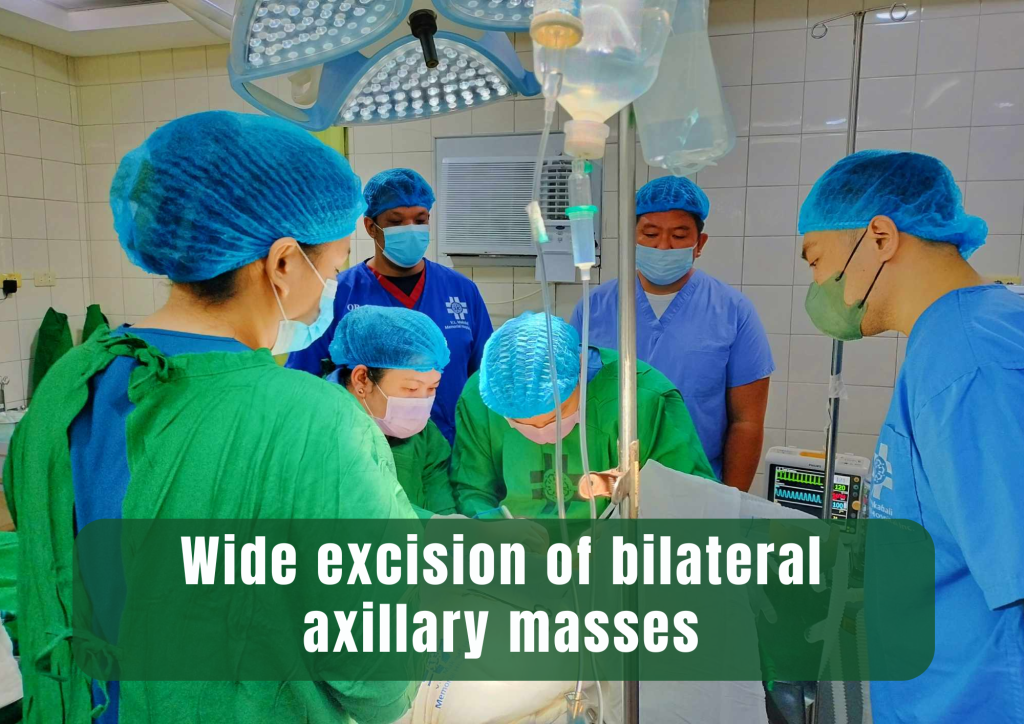 A Wide excision of bilateral axillary masses | V.L. Makabali Memorial ...