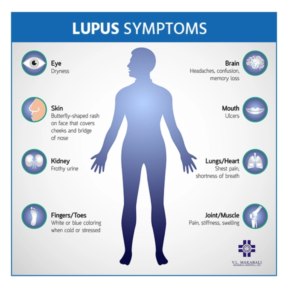 Lupus Awareness | V.L. Makabali Memorial Hospital, Inc.